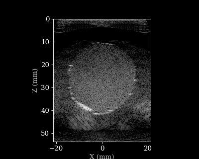 Color Doppler ultrasound - zea 0.0.13 documentation